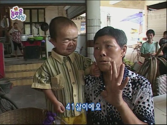 하이랜더 증후군 Highlander Syndrome 네이버 블로그