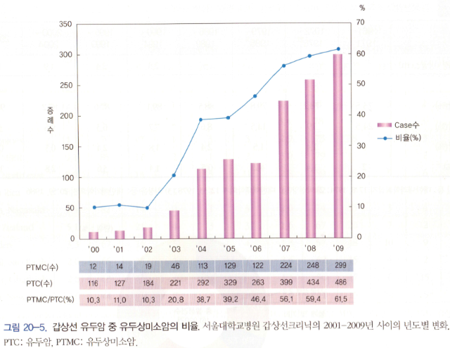 갑상선 역형성암 빈도 및 역학 원인 병리 네이버 블로그