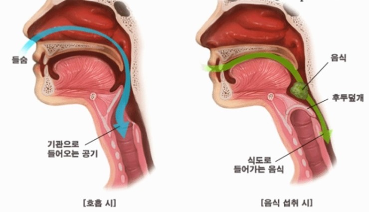 설기저부설근•구개•연구개•경구개•치조골•치조릉•잇몸치은•볼점막•후두덮개후두개회염•식도•기도기관 네이버 블로그