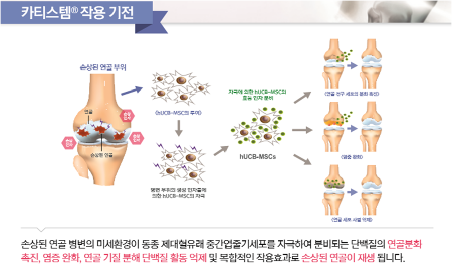 카티스템 줄기세포 치료 네이버 블로그