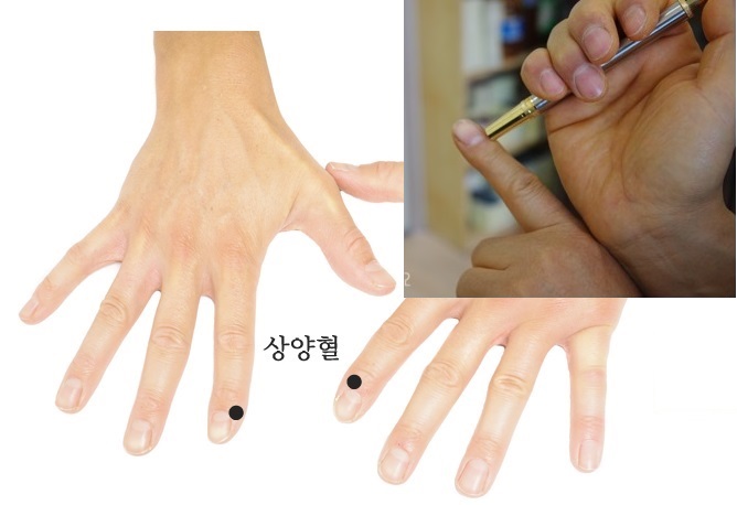 콕 찝어 알아둬야 할 사혈침 혈자리 7선 네이버 블로그