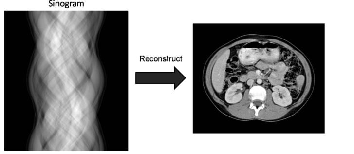 CT 와 sinogram : 네이버 블로그