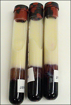 이차돈의 피는 정말 하얀색 이었을까? : 네이버 블로그