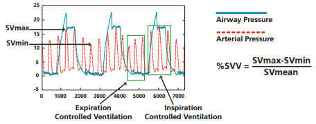 Stroke volume variation : 네이버 블로그
