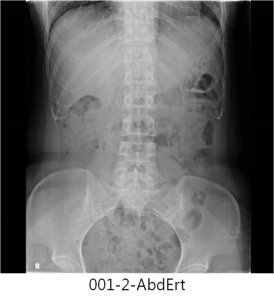 복부 정상소견 : 네이버 블로그