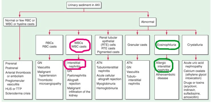 AKI (Prerenal AKI, Intrinsic AKI, Acute tubulointerstitial nephritis ...