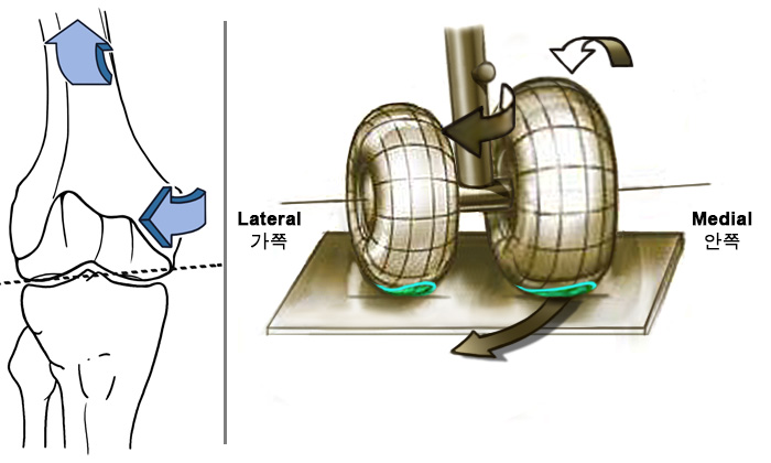 Screw-home (나사잠김) 매커니즘에 관하여.. : 네이버 블로그