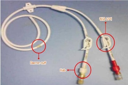 Hickman catheter(히크만 카테터) : 네이버 블로그