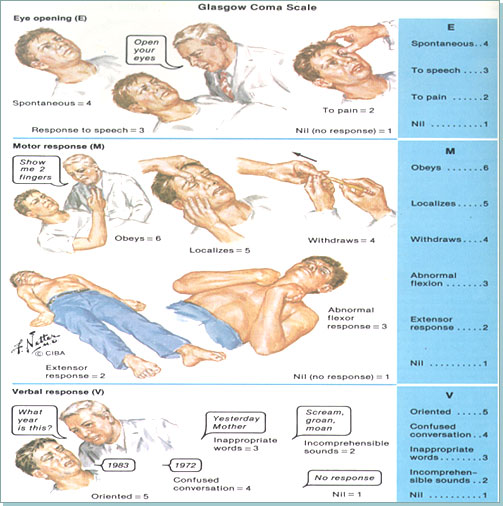 통증 평가 도구, 의식수준, GCS(Glasgow Coma Scale), 동공 크기와 반사, 사지 움직임 평가 : 네이버 블로그