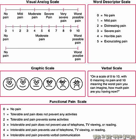 통증평가도구, 통증평가척도 - VAS, NRS, FPRS, FLACC, CRIES : 네이버 블로그