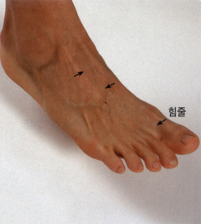 Extensor Hallucis Longus Palpation