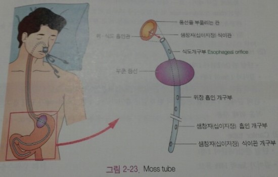6.위장관 삽관(Gastrointestinal Intubation) : 네이버 블로그