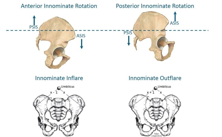 움직임을 위한 용어 - Torsion, Inflare, Outflare, Nutation : 네이버 블로그