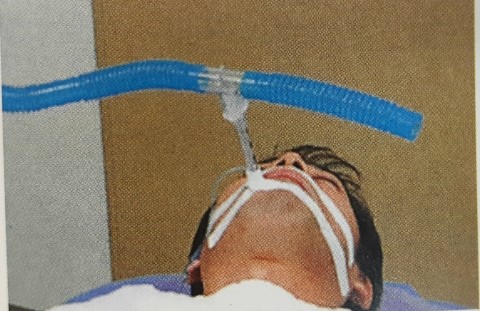 인공호흡기 발관, Extubation, Weaning, T-piece : 네이버 블로그