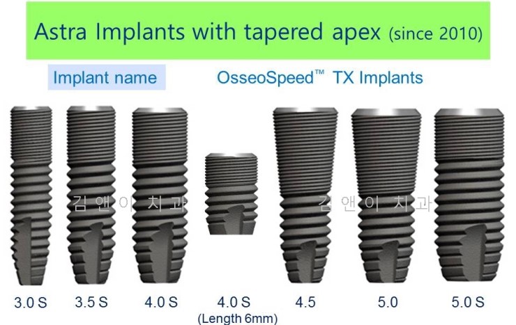The birth and evolution of Astra Implants(아스트라 임플란트의 탄생과 진화) : 네이버 블로그