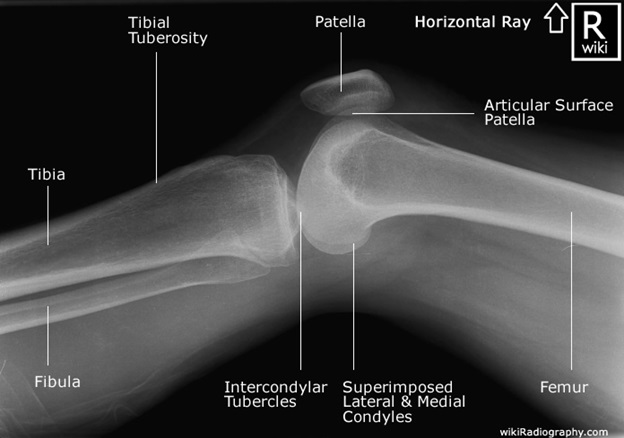 Knee X-ray의 Anatomy와 Positioning : 네이버 블로그