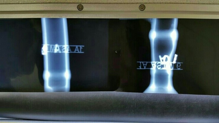 용접검사(비파괴검사)의 종류및 내용 ( RT / UT / MT / PT / LT / VT) : 네이버 블로그
