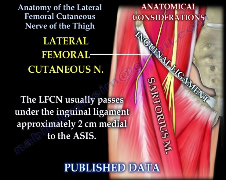 외측대퇴피부신경 포착(lateral femoral cutaneous nerve entrapment) : 네이버 블로그
