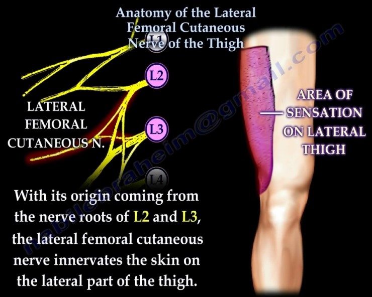 외측대퇴피부신경 포착(lateral femoral cutaneous nerve entrapment) : 네이버 블로그